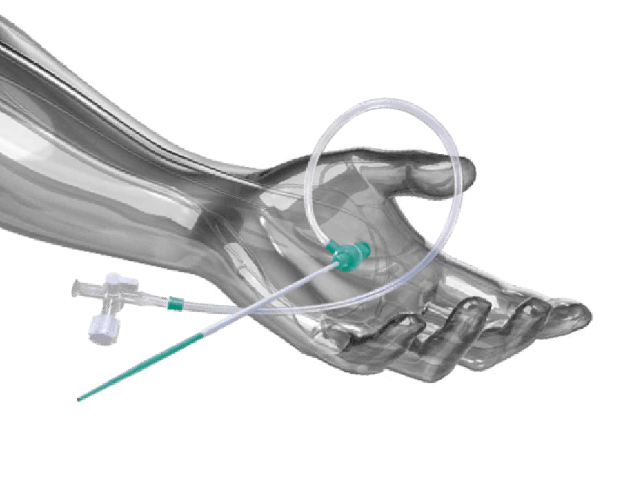 Railway Seathless access system – Endovas